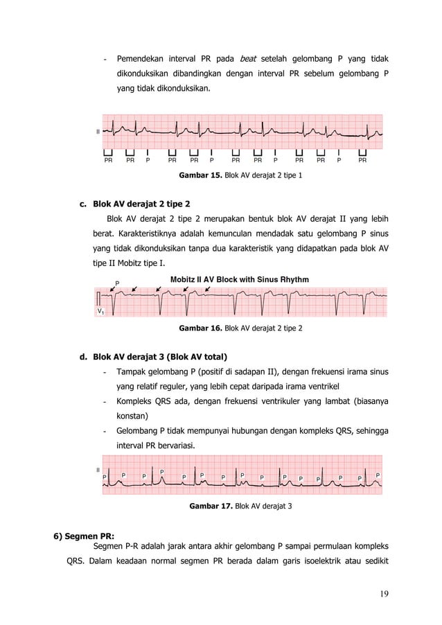smt-4-Interpretasi-EKG.pdf
