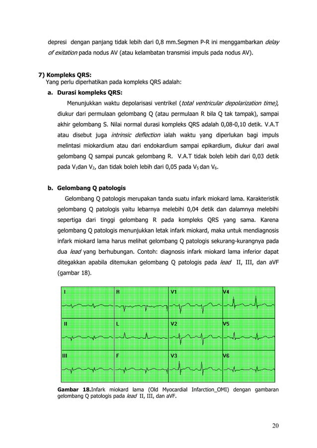 smt-4-Interpretasi-EKG.pdf