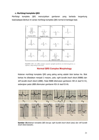 smt-4-Interpretasi-EKG.pdf