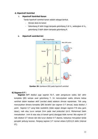 smt-4-Interpretasi-EKG.pdf