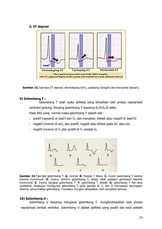 smt-4-Interpretasi-EKG.pdf