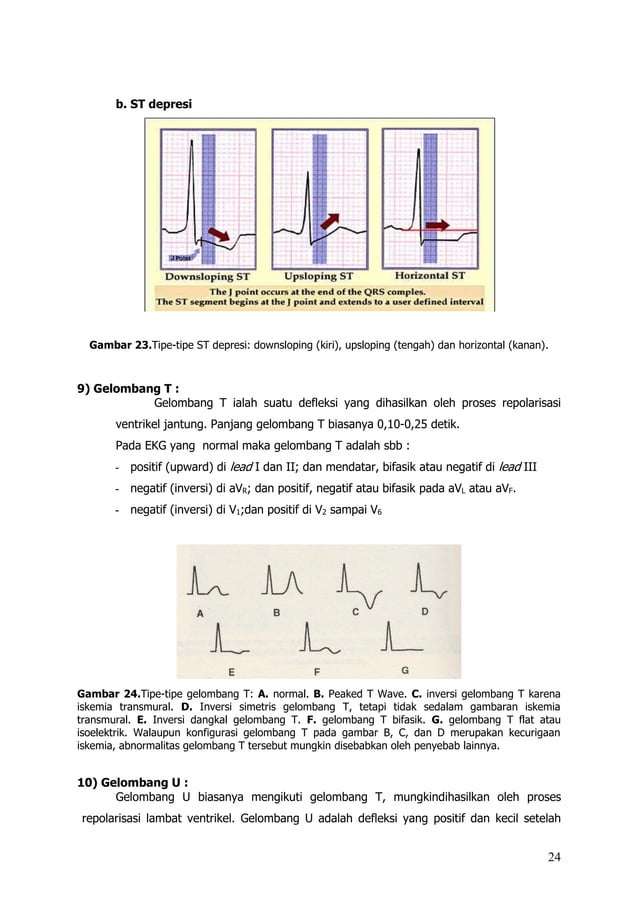 smt-4-Interpretasi-EKG.pdf