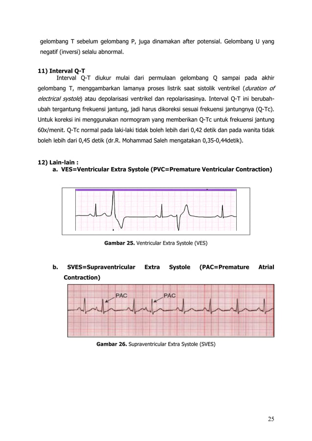 smt-4-Interpretasi-EKG.pdf