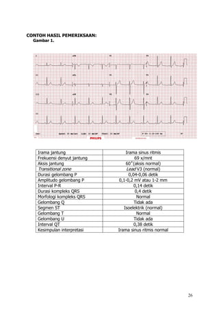 smt-4-Interpretasi-EKG.pdf