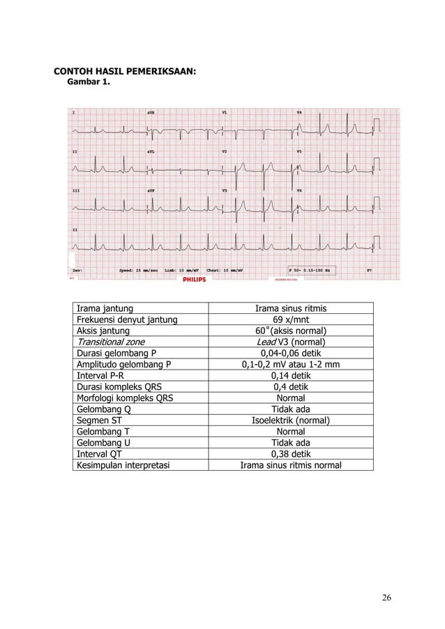 smt-4-Interpretasi-EKG.pdf