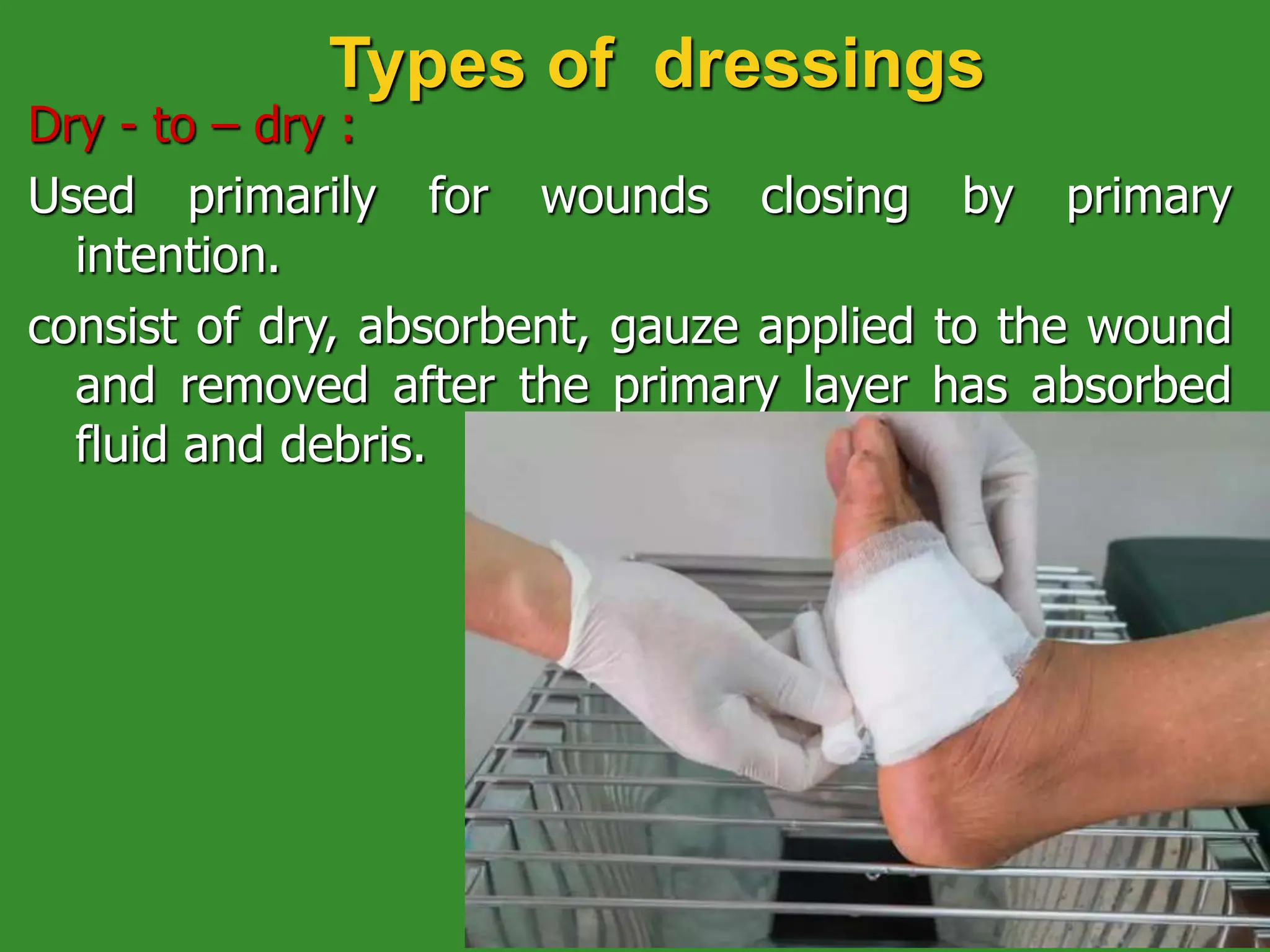 SMTC Wound dressingSMTC Wound dressingTT | PPT