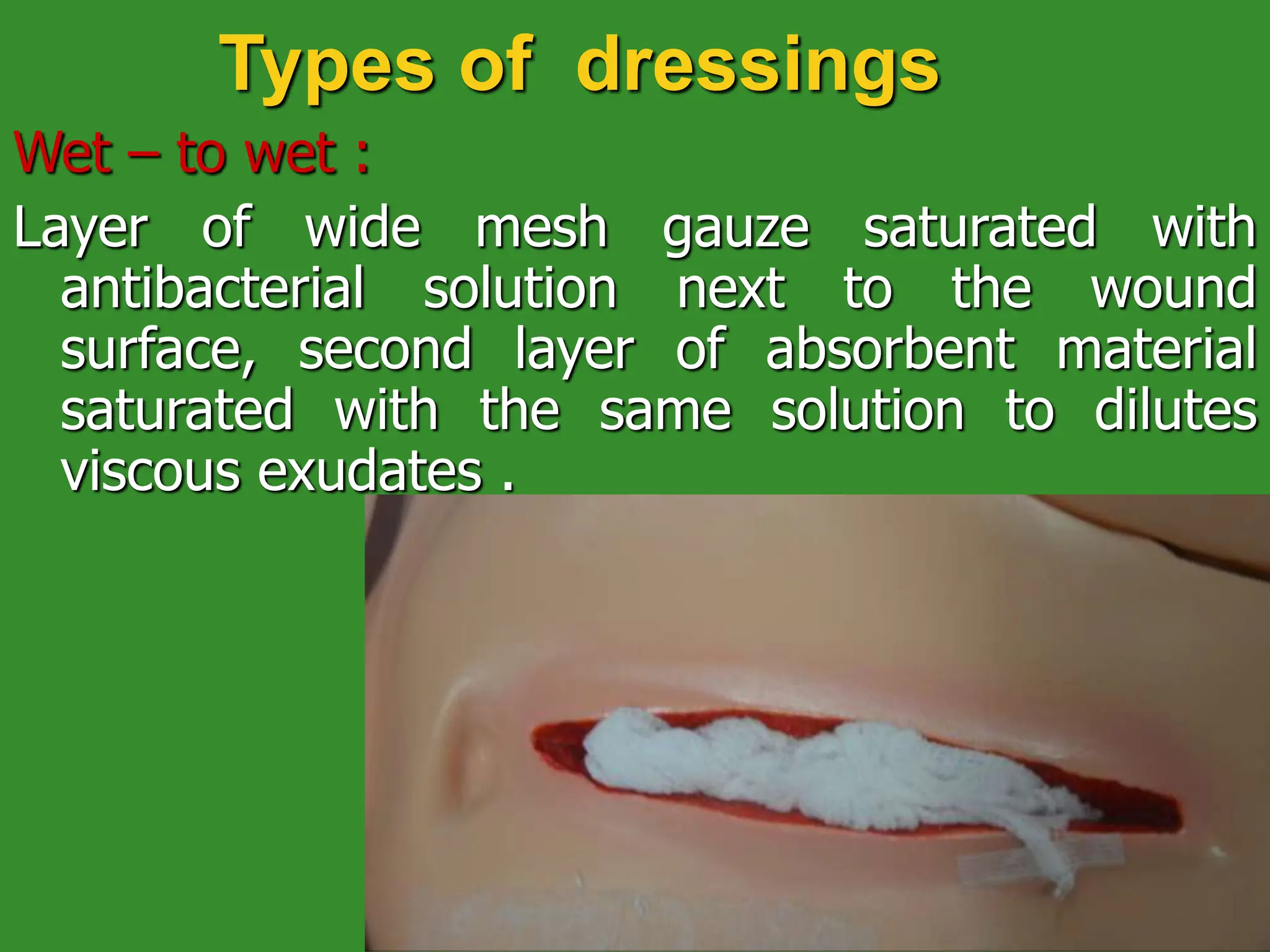 SMTC Wound dressingSMTC Wound dressingTT | PPT