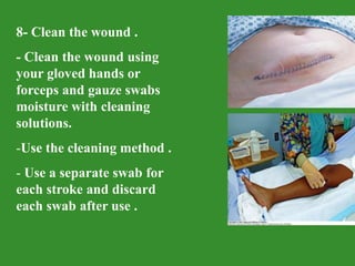 SMTC Wound dressingSMTC Wound dressingTT | PPT