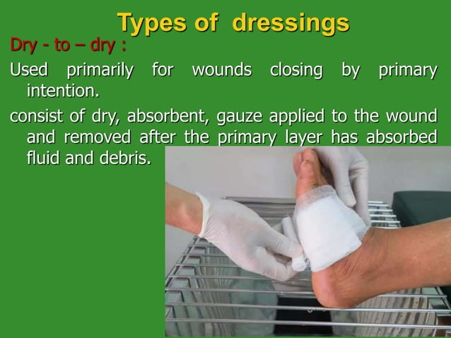 SMTC Wound dressingSMTC Wound dressingTT | PPT