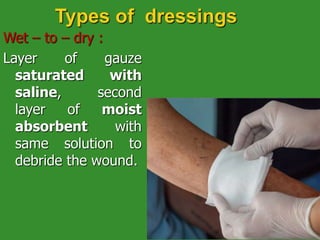 SMTC Wound dressingSMTC Wound dressingTT | PPT