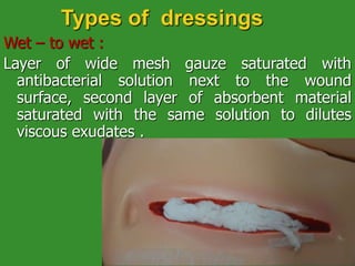 SMTC Wound dressingSMTC Wound dressingTT | PPT