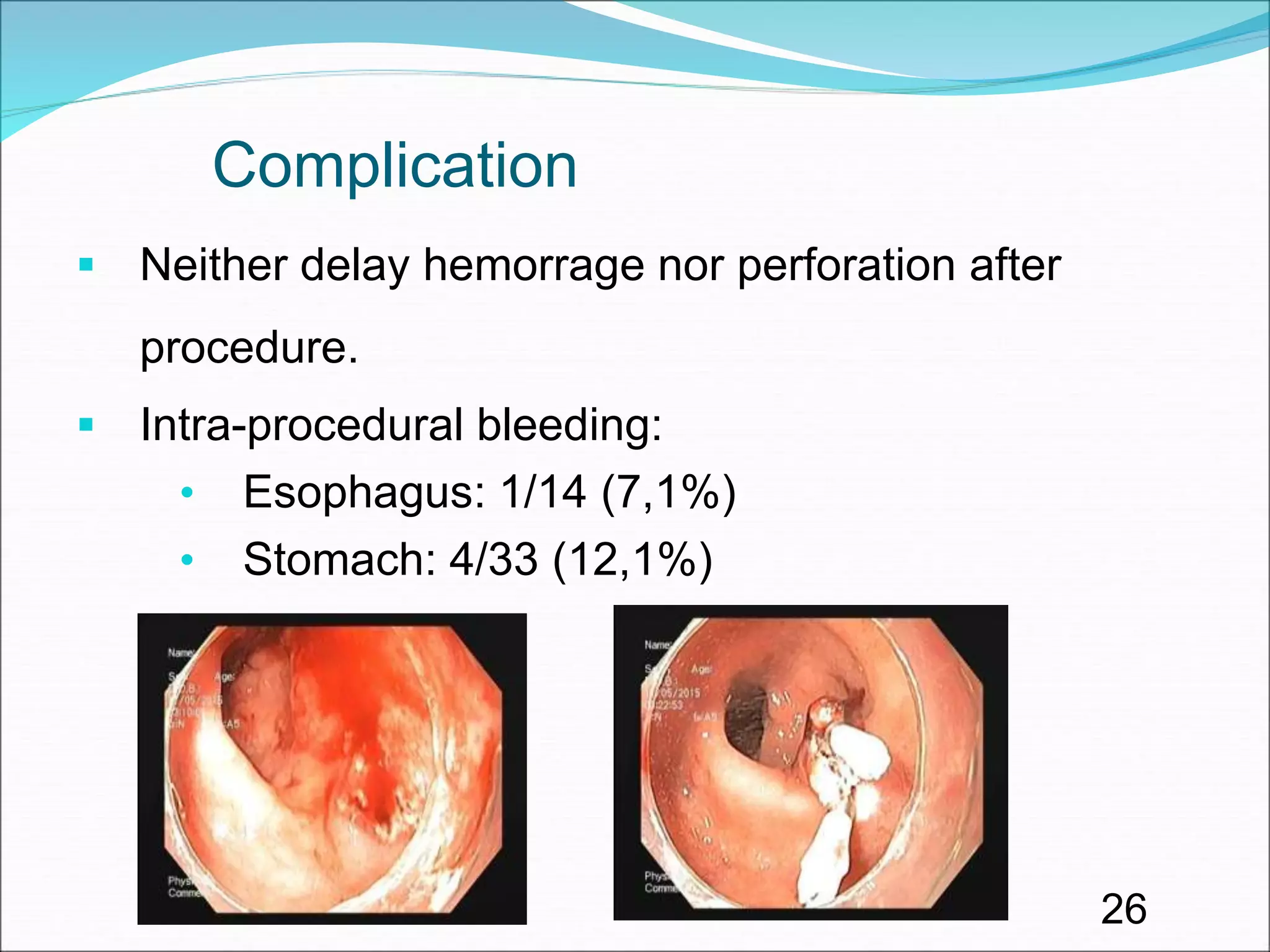 Clinical, endoscopic imaging and the value of endoscopic biopsy by ...