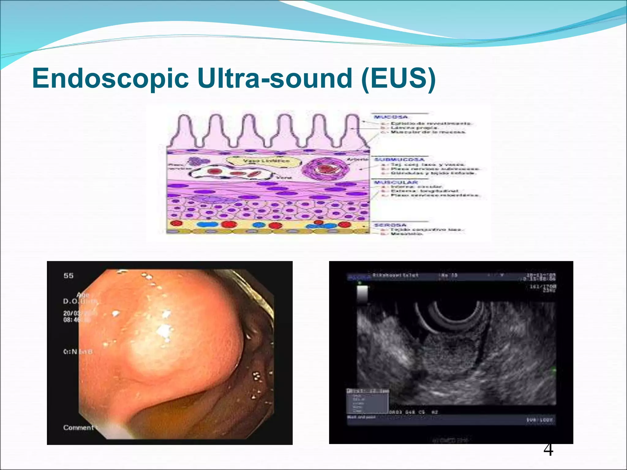 Clinical, endoscopic imaging and the value of endoscopic biopsy by ...
