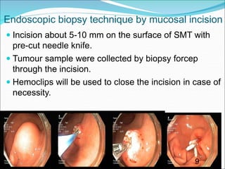 Clinical, endoscopic imaging and the value of endoscopic biopsy by ...