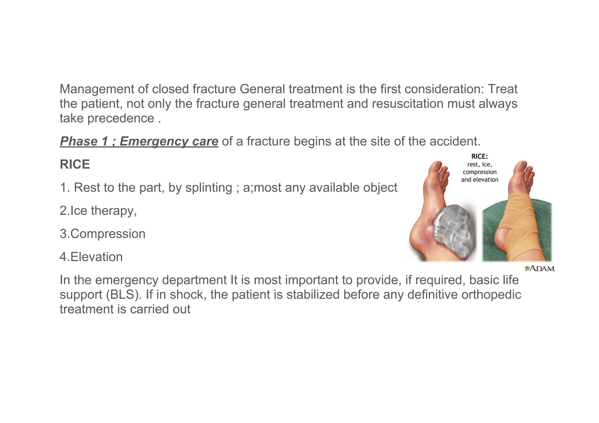 Definitive Management Of Closed Fracture And Management Of Open