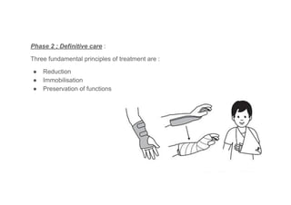 Definitive management of Closed Fracture and Management of Open ...