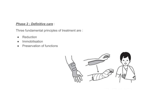 Definitive Management Of Closed Fracture And Management Of Open