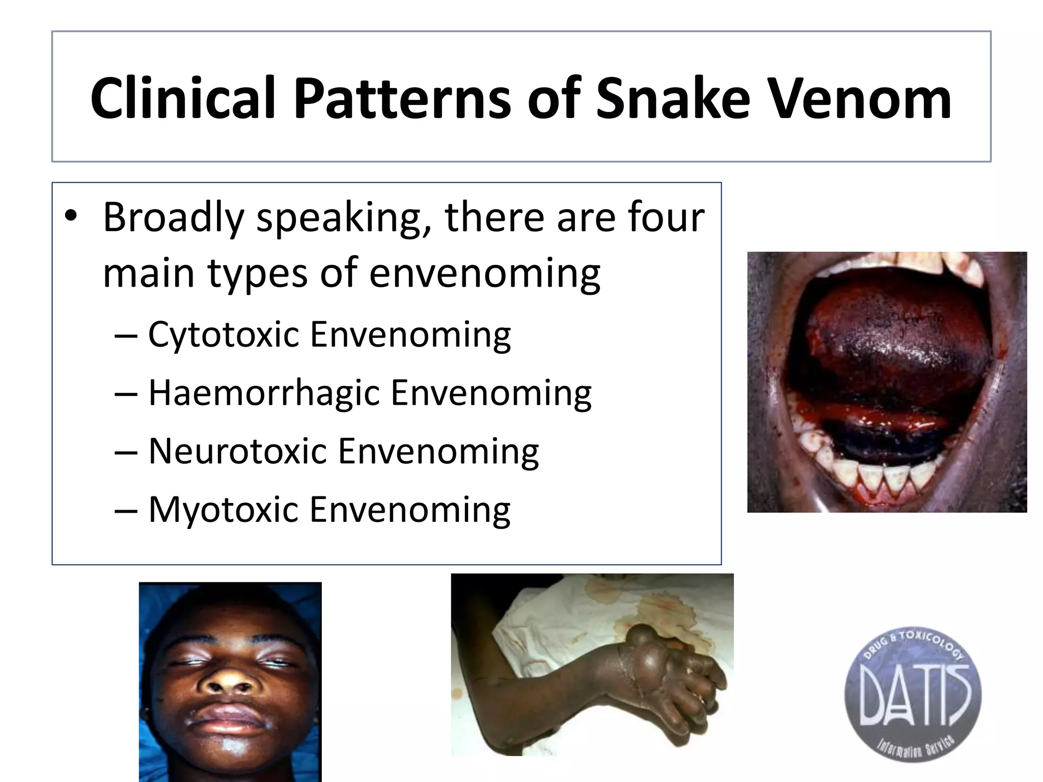 Snakebite in Zimbabwe: An Overview of Snake Antivenon | PPTX