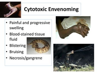 Snakebite in Zimbabwe: An Overview of Snake Antivenon | PPTX