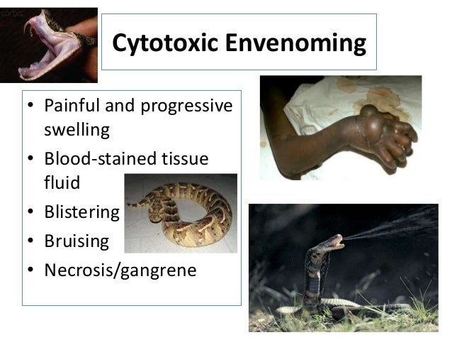 Snakebite in Zimbabwe: An Overview of Snake Antivenon