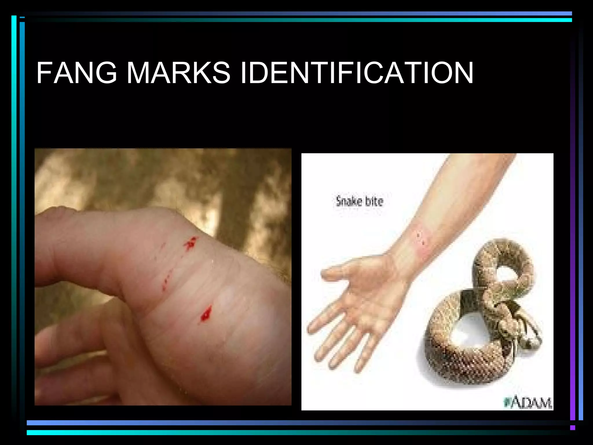 Snakebite | PPT