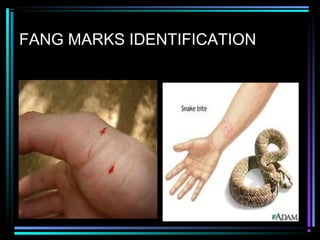 Snakebite | PPT