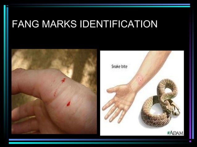 Snakebite | PPT | First Aid | Injuries