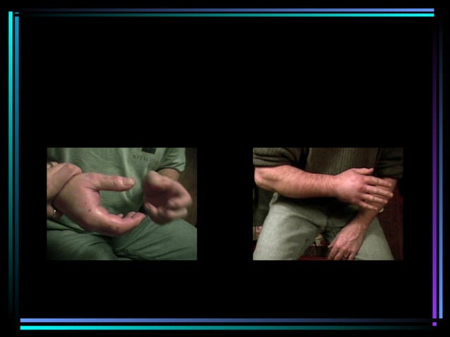 Snakebite | PPT | First Aid | Injuries