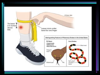 Snakebite | PPT