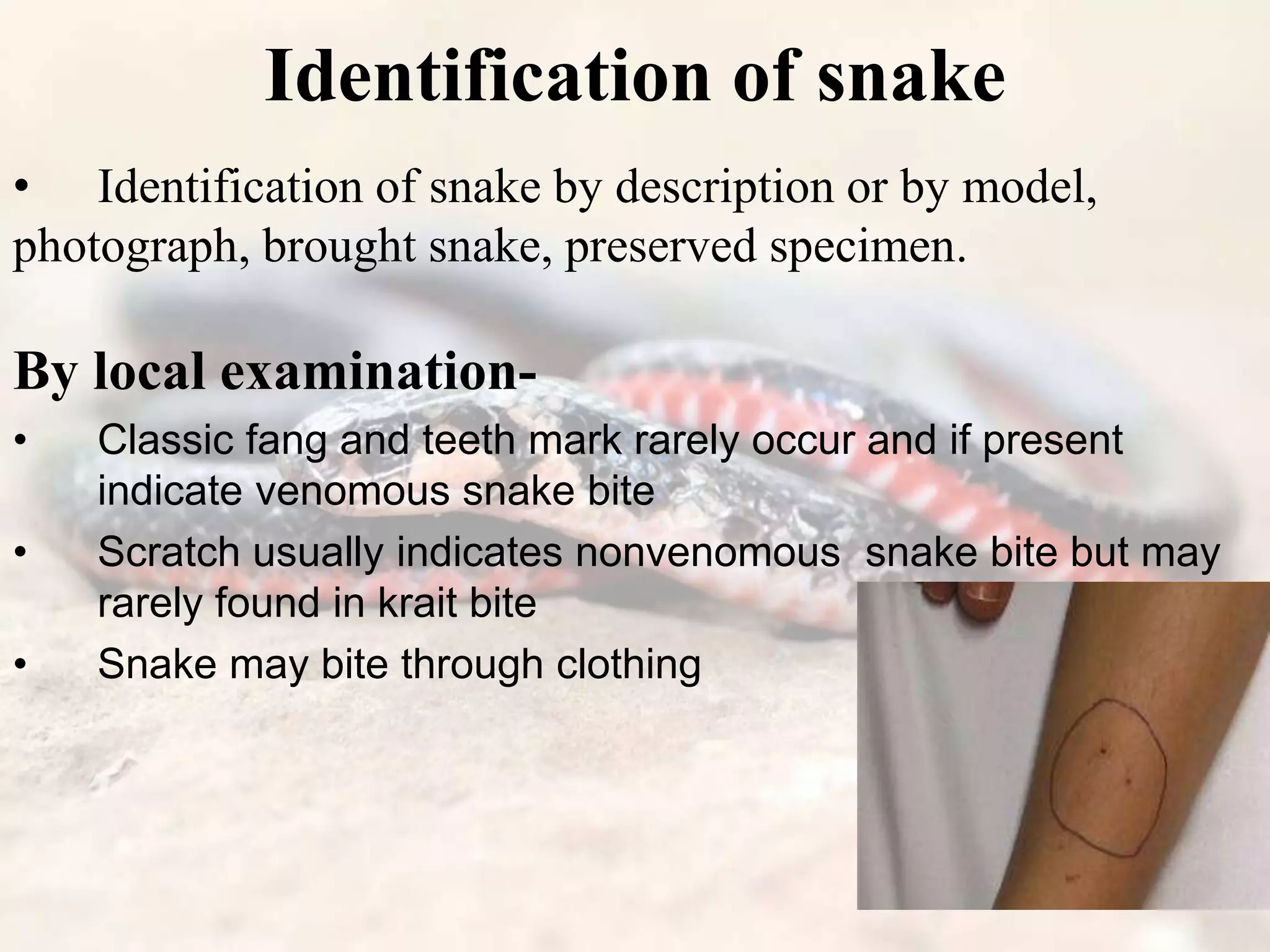 management of Snake bite | PPTX