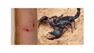 Snake bite .. scorpion sting | PDF