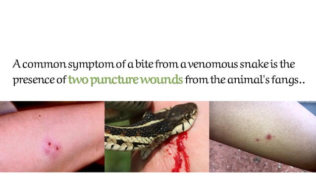 Snake bite .. scorpion sting | PDF