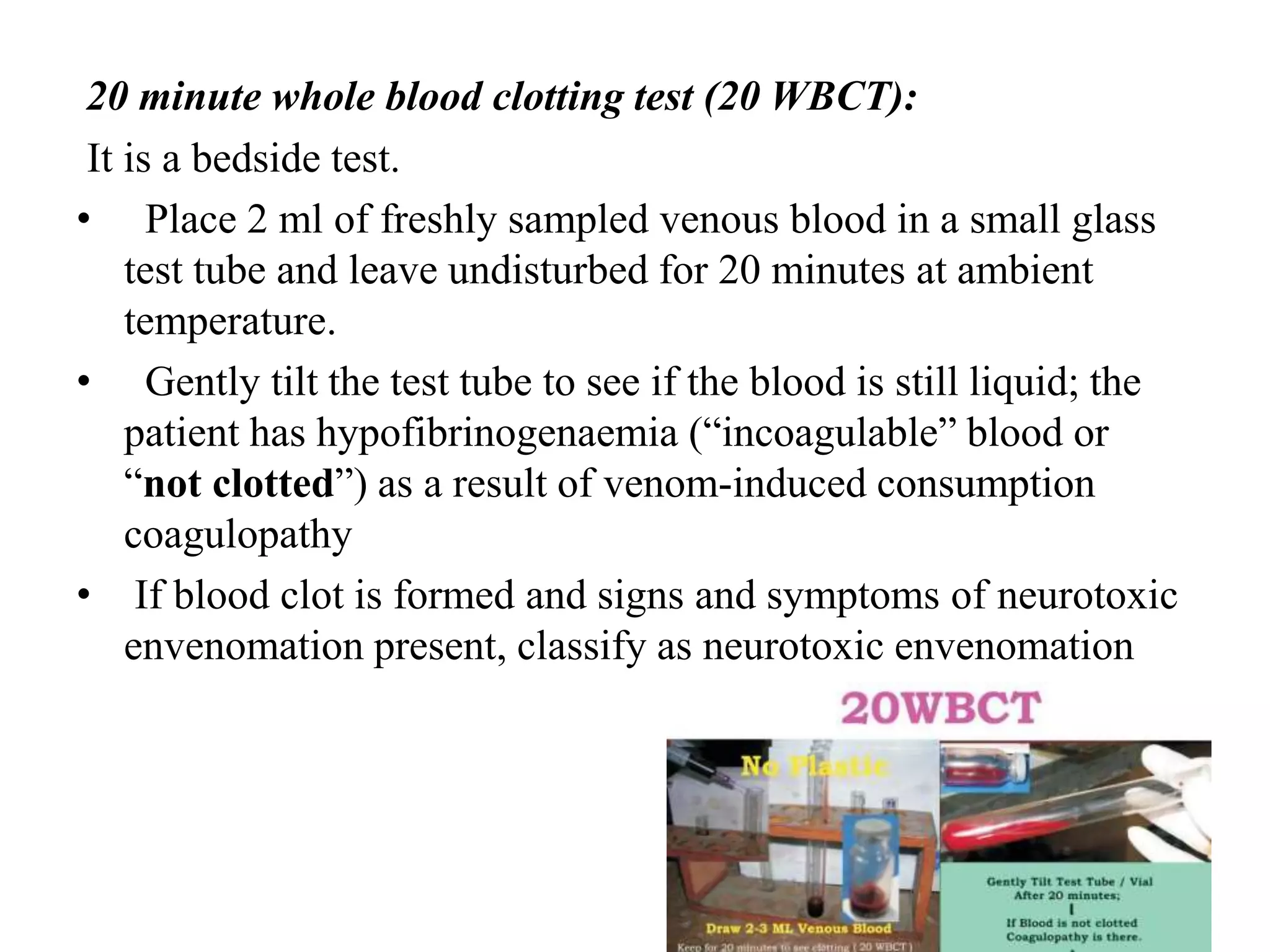 Snake bite - ASV Protocols and Management - Antisnake Venom | PPTX