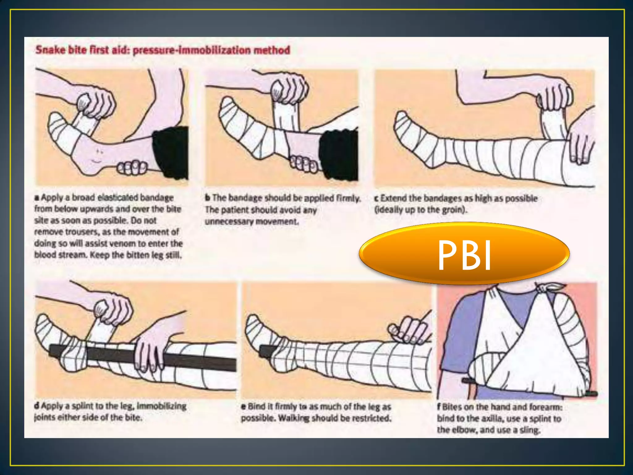 Snake Bite pdf snake-bite-pdf