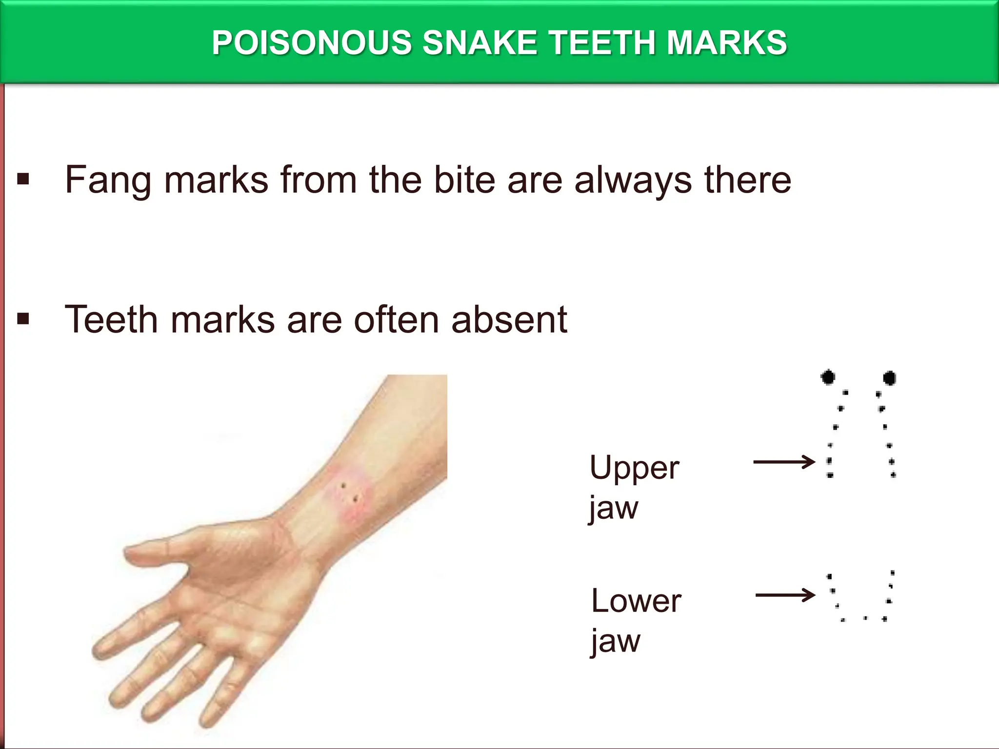 "Venomous Encounters: Understanding the Physiology, Treatment, and ...