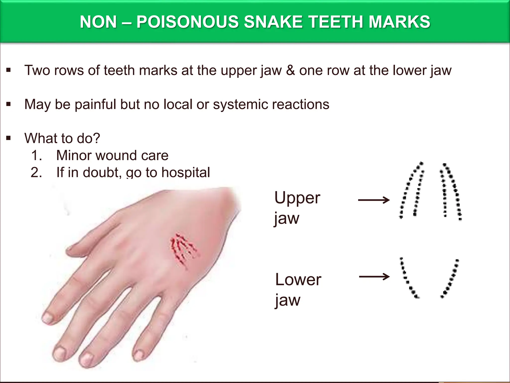 "Venomous Encounters: Understanding the Physiology, Treatment, and ...