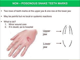 "Venomous Encounters: Understanding the Physiology, Treatment, and ...
