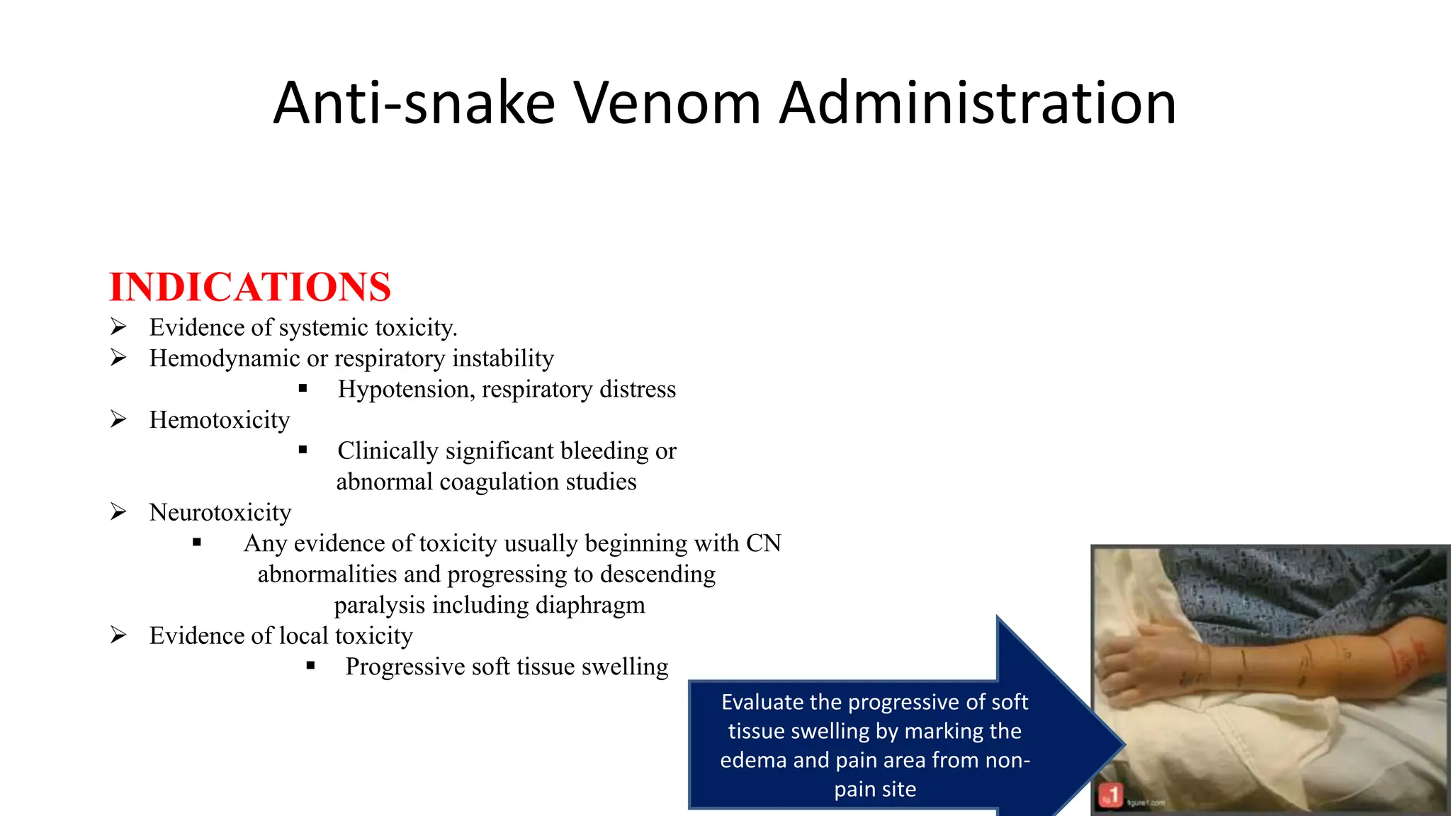 SNAKE BITE (penanganan dan juga pertolongan pertama pada gigitan ular).pptx