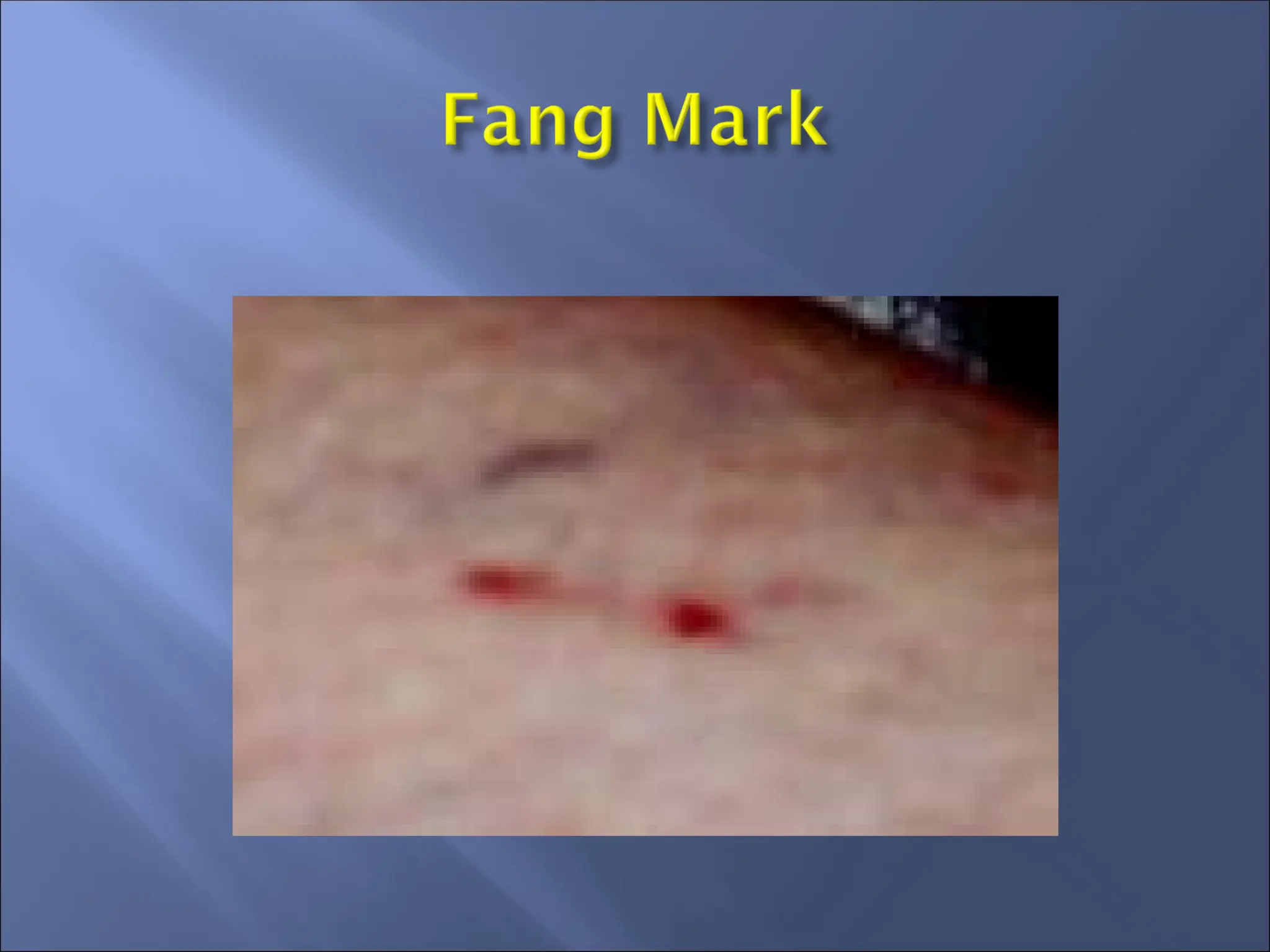Snake Bite.ppt when a snake bites you what to do then | PPT
