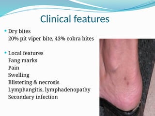 snake bite, Detection,first aid and treatment | PPTX