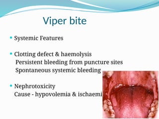 snake bite, Detection,first aid and treatment | PPTX