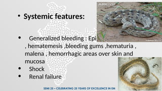 SNAKE BITE - types and management profile | PPTX