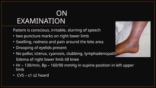 Snake bite and Management by Dr Sowmya.pptx