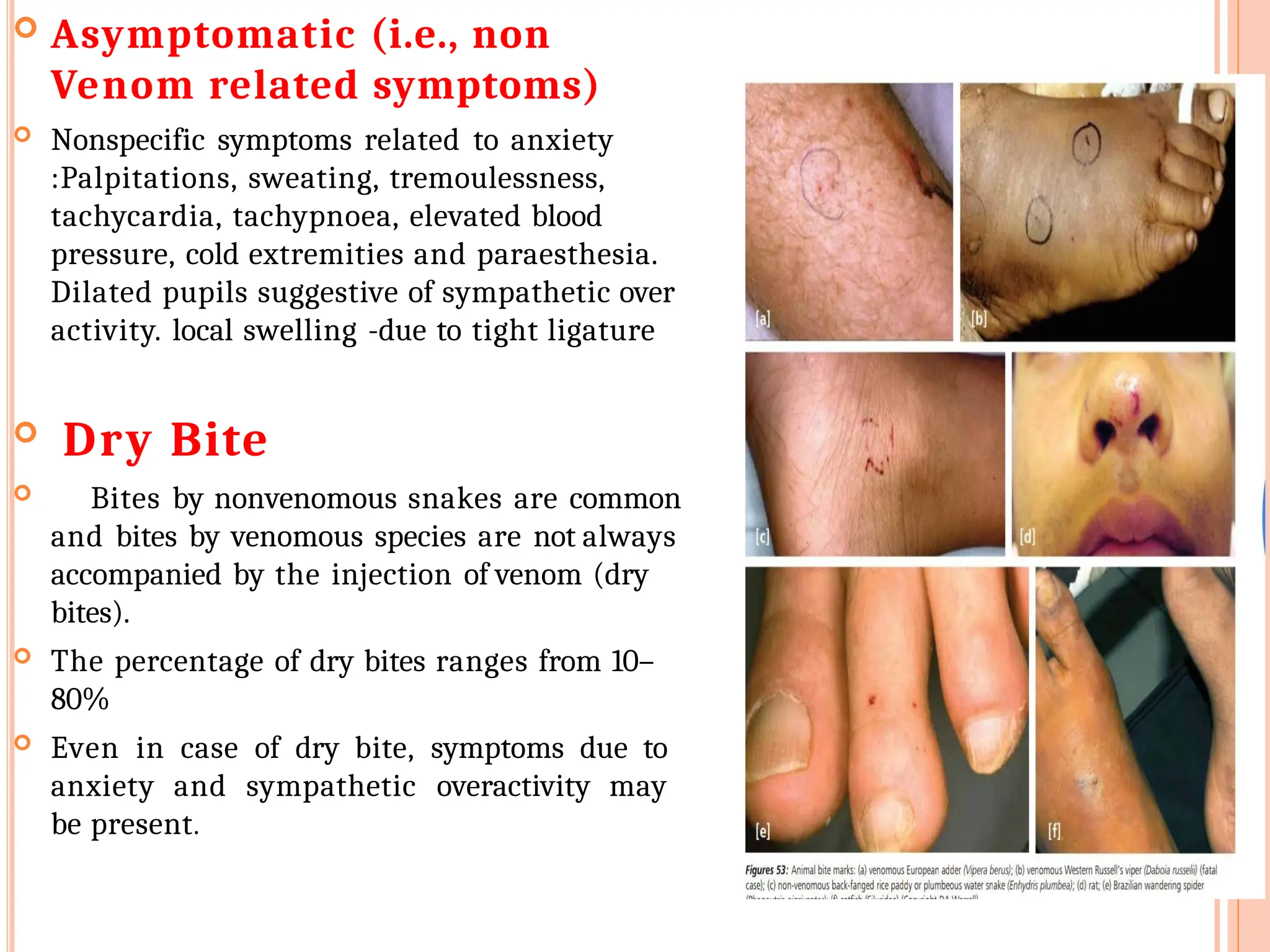 snake+bite.ppt.pptx snake bite presentation | PPTX
