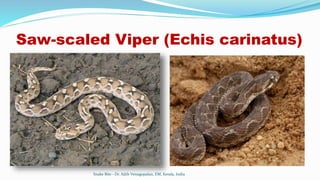 Snake Bite - Evaluation & Management in India - Dr. Ajith Venugopalan ...