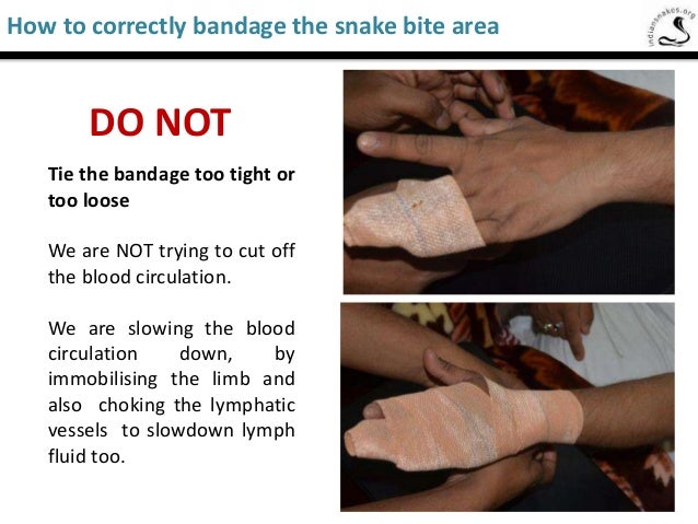 Snake Bite! - Firstaid, Facts & Prevention