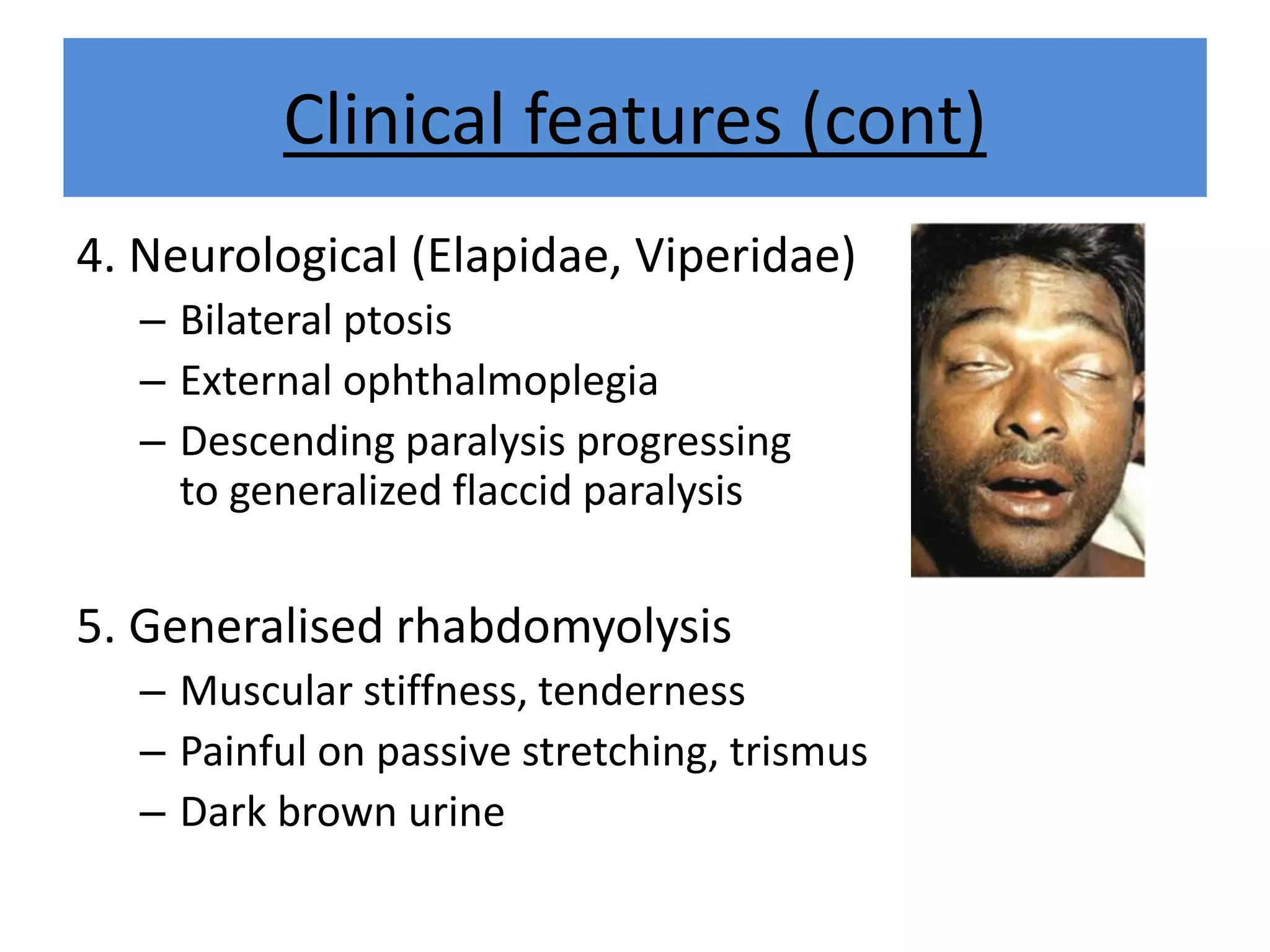 Snake bite management in India | PPTX
