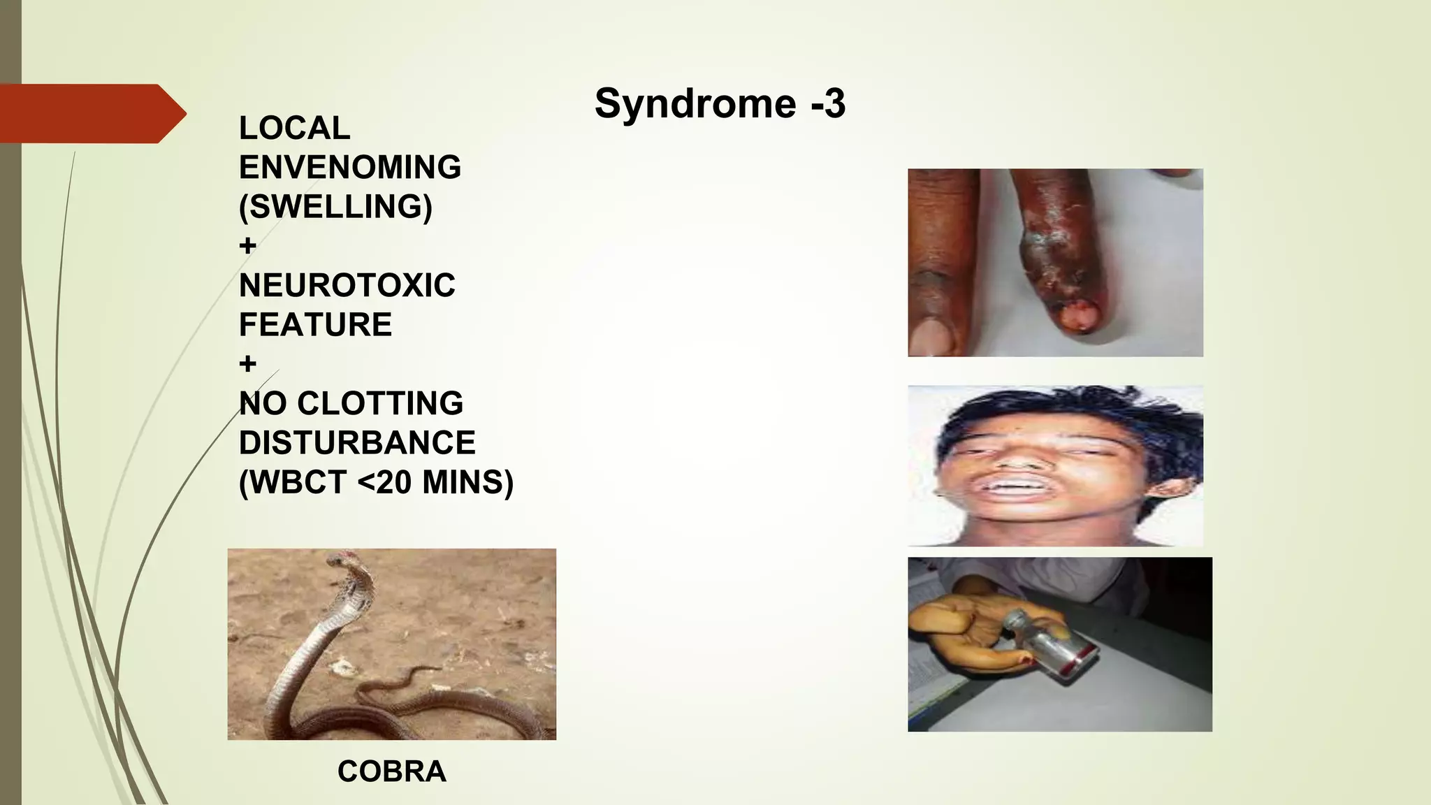 Snake Bite Management Bangladesh.pptx