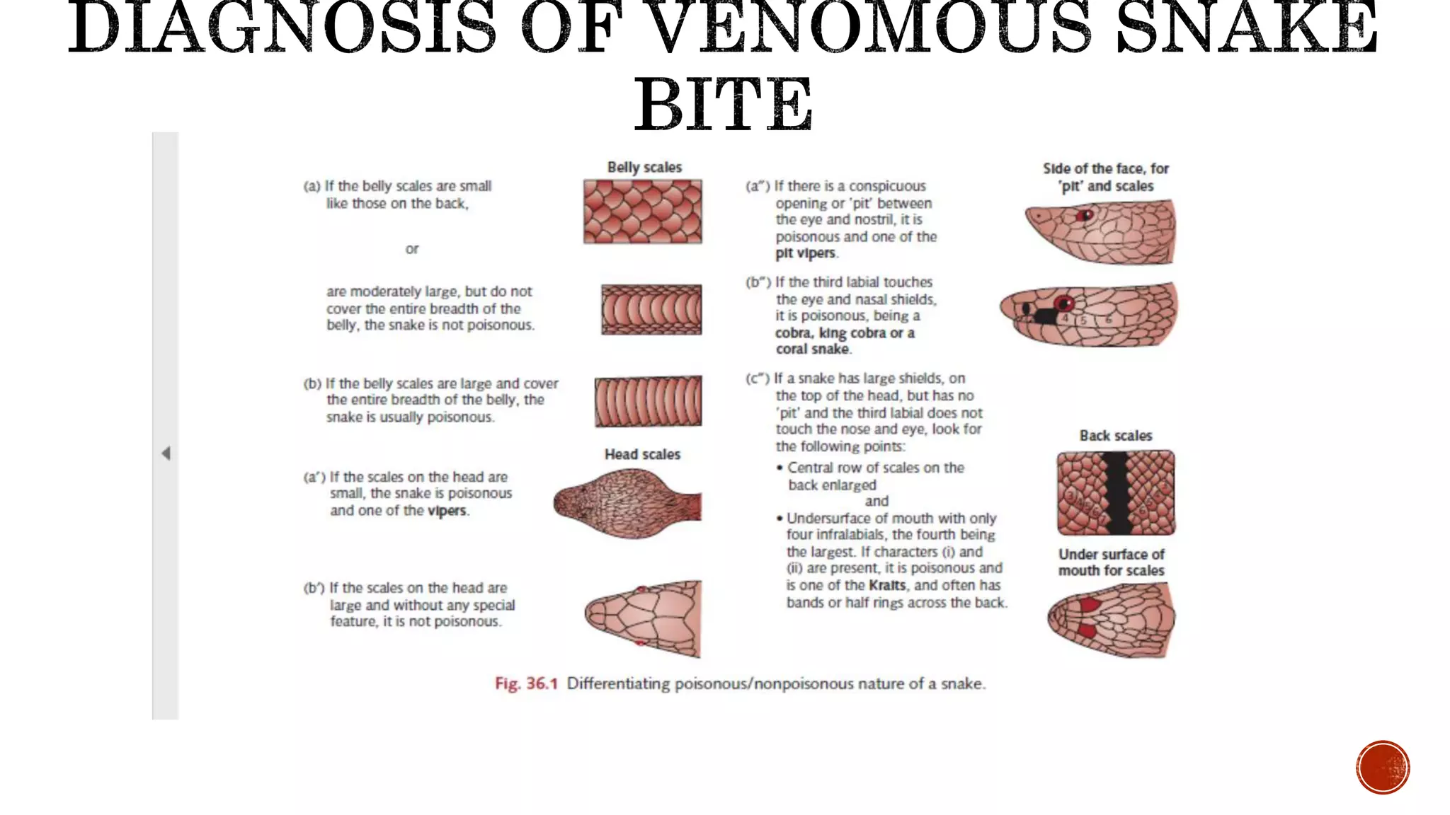 Snake bite poisoning and its treatment by RxVichuZ! | PPTX