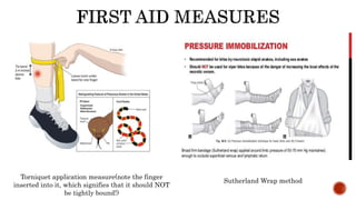 Snake bite poisoning and its treatment by RxVichuZ! | PPTX